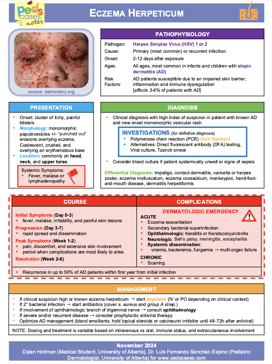 Eczema Herpeticum | PedsCases